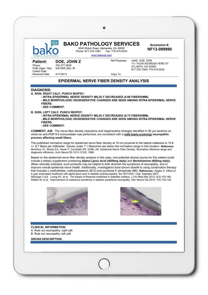Epidermal Nerve Fiber Density Enfd Testing Bako Diagnostics